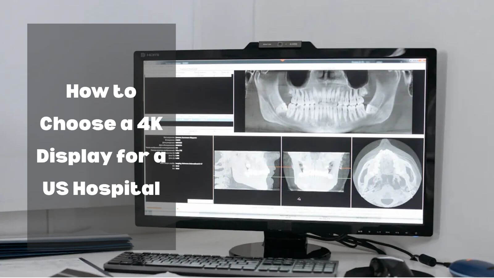 How to Choose a 4K Display for a US Hospital - AIMedik
